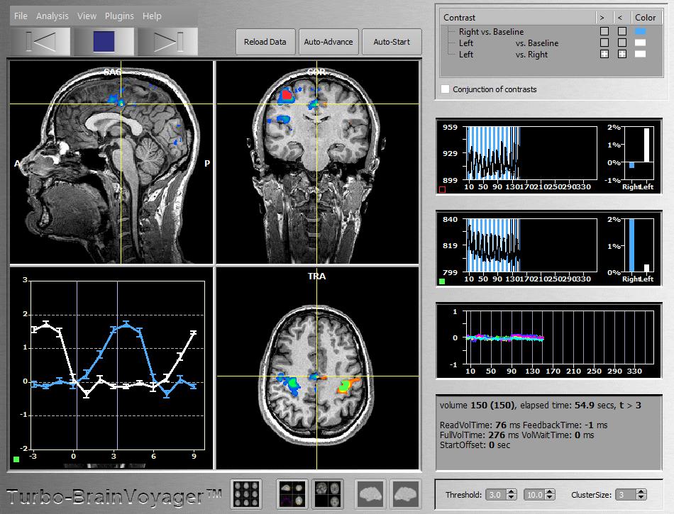 Israeli Tech and Innovation News - NoCamels