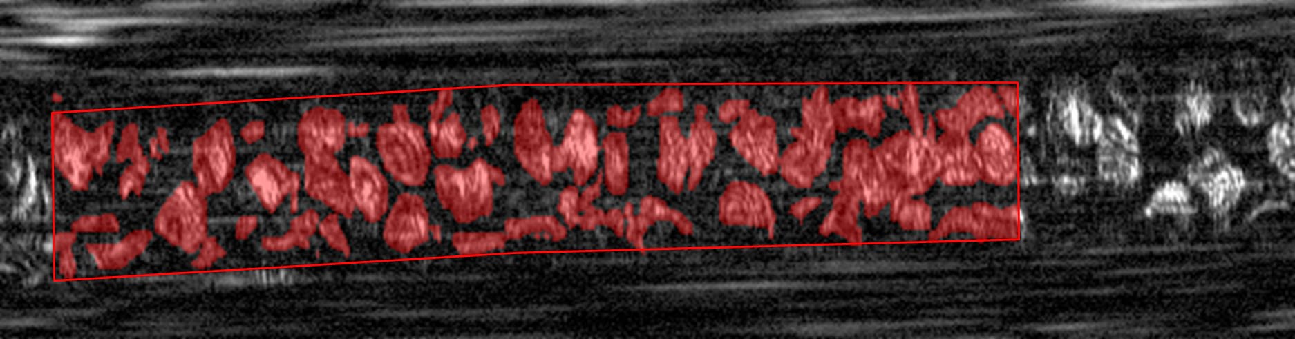 New Microscope Can See Blood Cells Through Our Skin