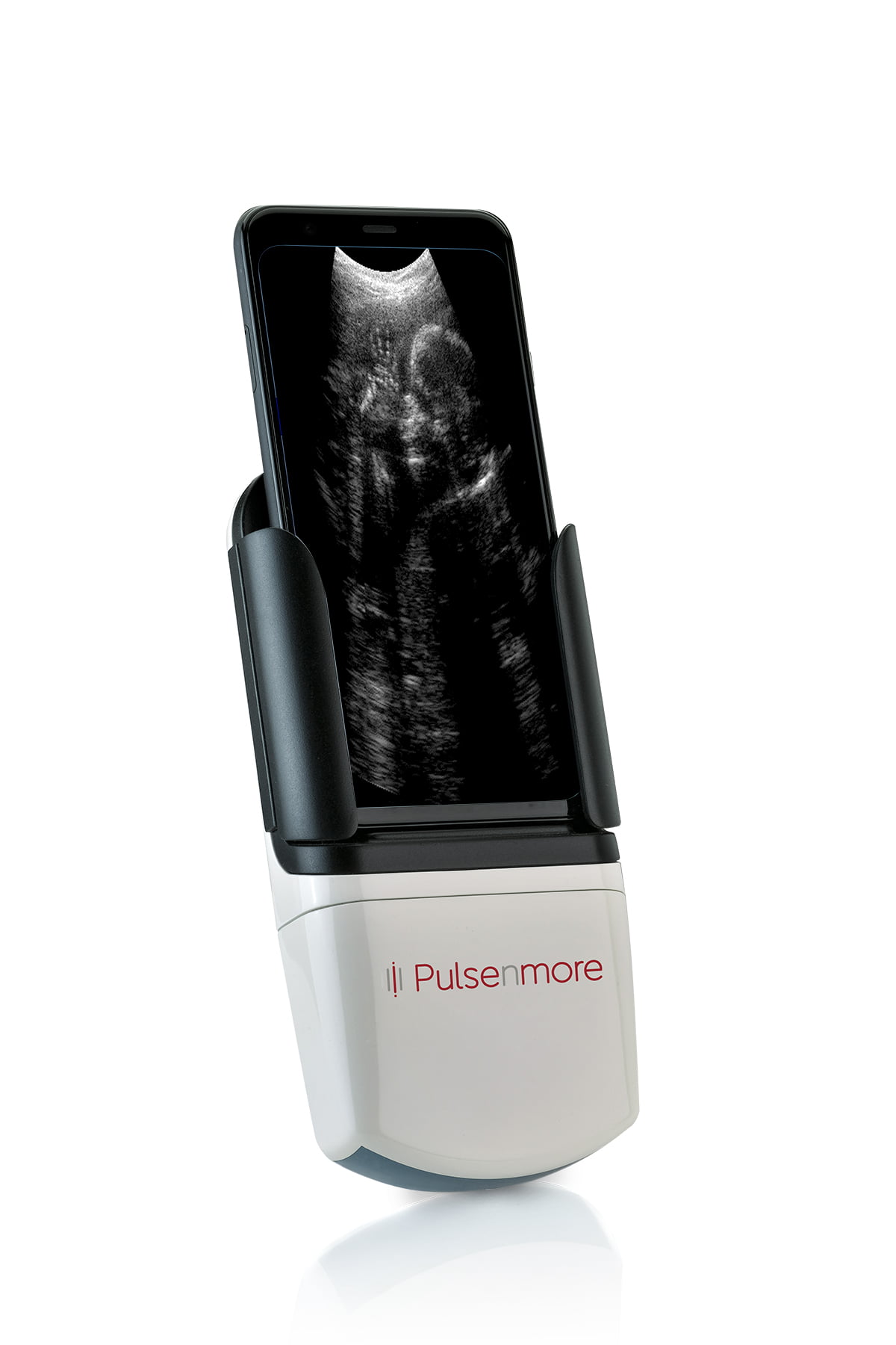 PulseNmore Offers Home Pregnancy Ultrasounds With Handheld Device