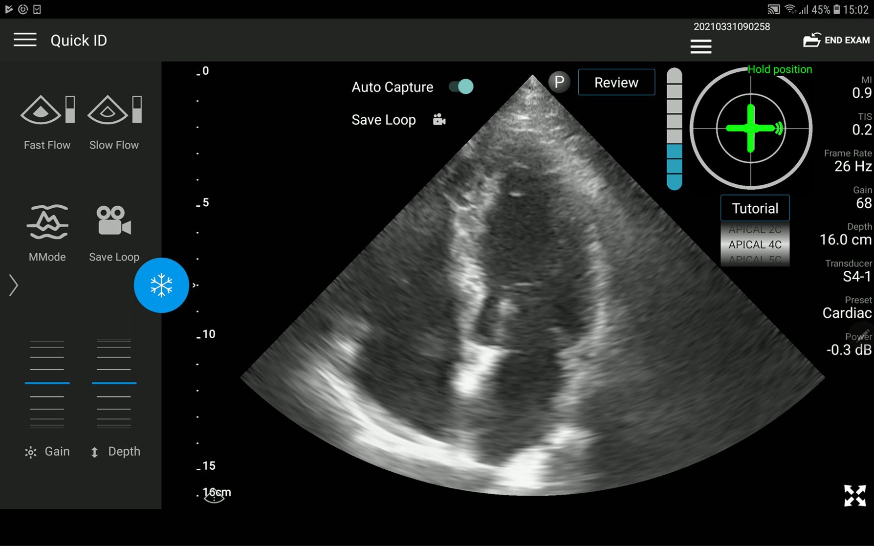 Digital Health Startup UltraSight Raises $13M For AI Cardiac Sonography