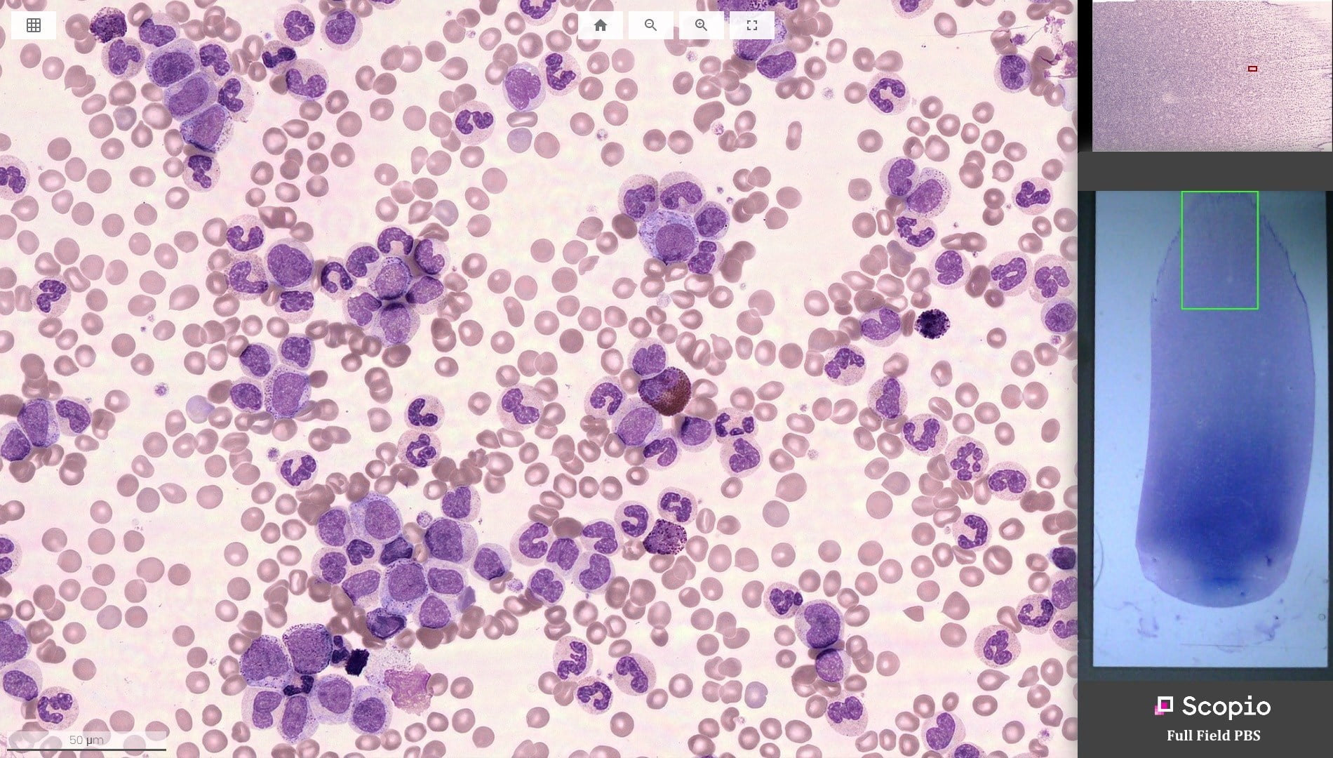 Scopio Labs Gets FDA Clearance For Blood Smear Device