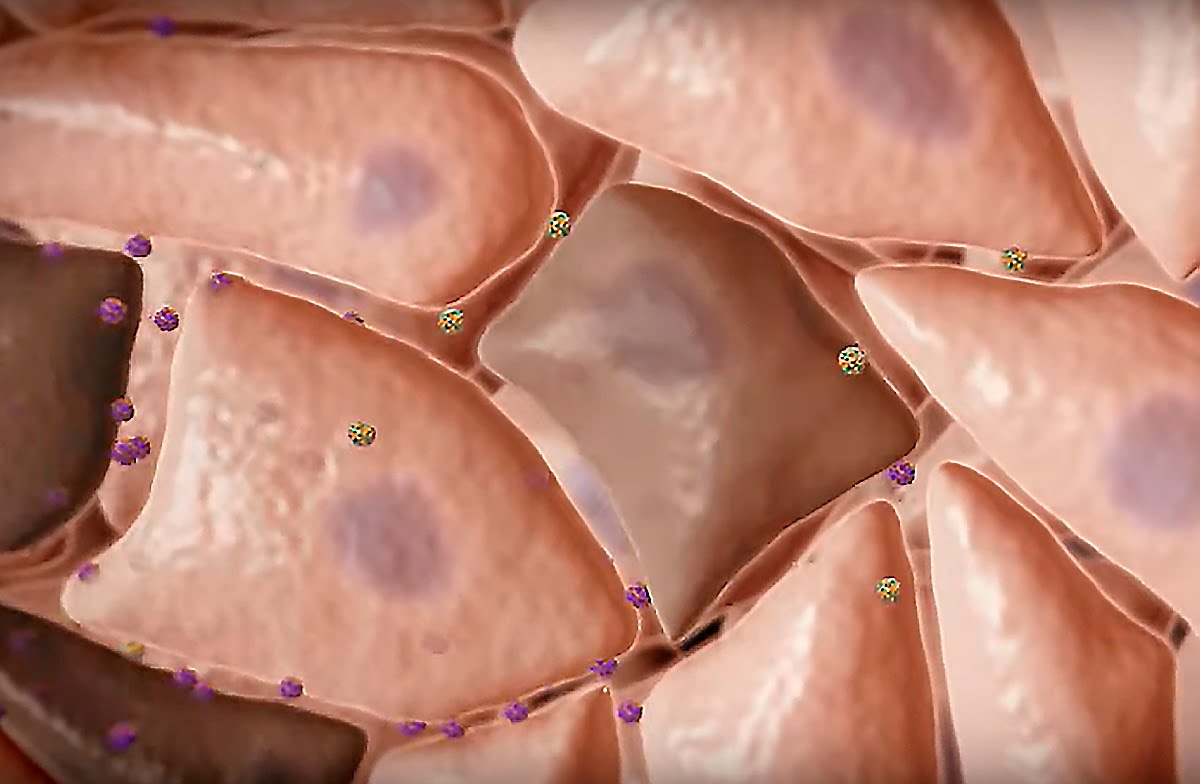 Israeli Researchers Use Breakthrough Tech To Treat Prostate Cancer