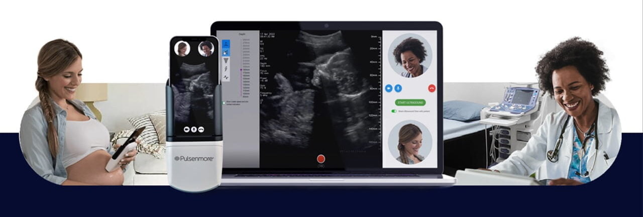 DIY Ultrasound Shows Moms-To-Be Their Baby Anytime, Anywhere
