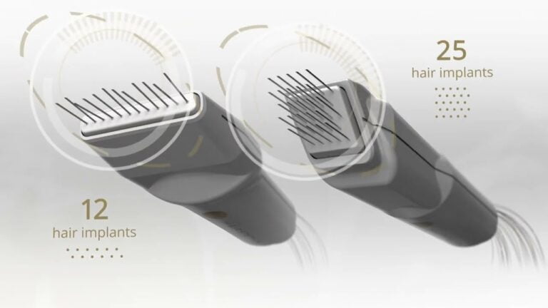 Implants Offer Women With Alopecia Chance To Restore Hair