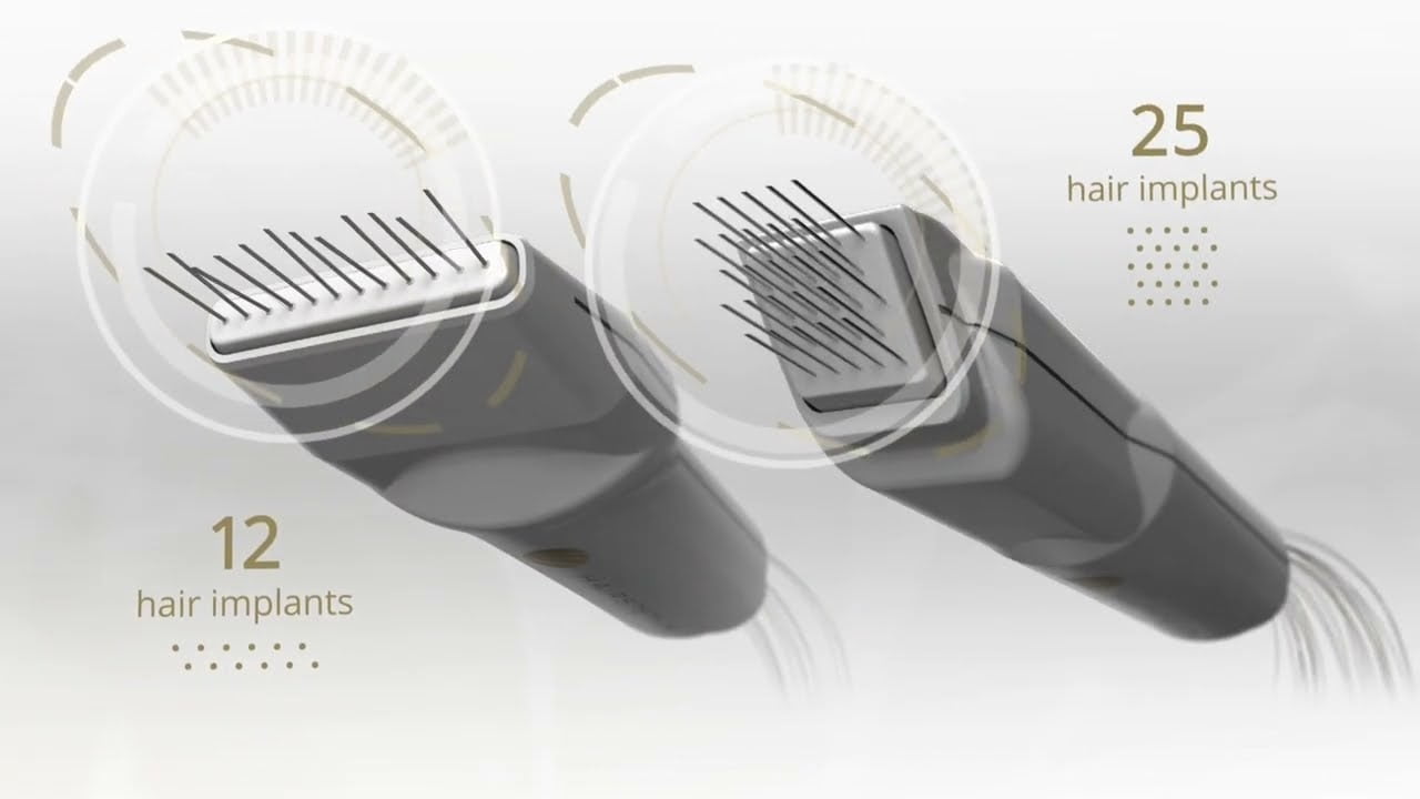 Implants Offer Women With Alopecia Chance To Restore Hair