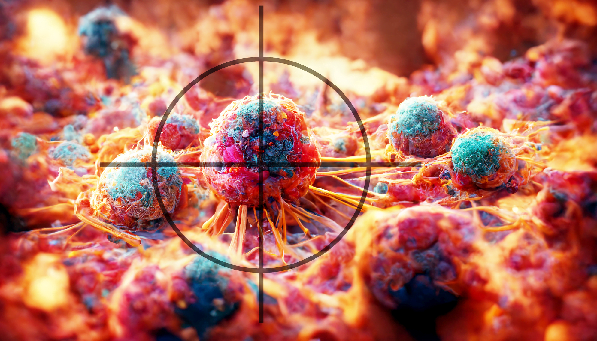 Scanner Hunts Tiny Cancerous Cells In Real Time During Surgery