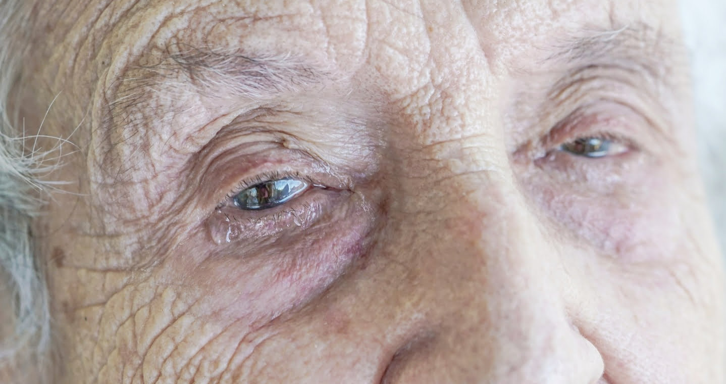 Tracking Your Tears In Early Test For Alzheimer's And Parkinson's