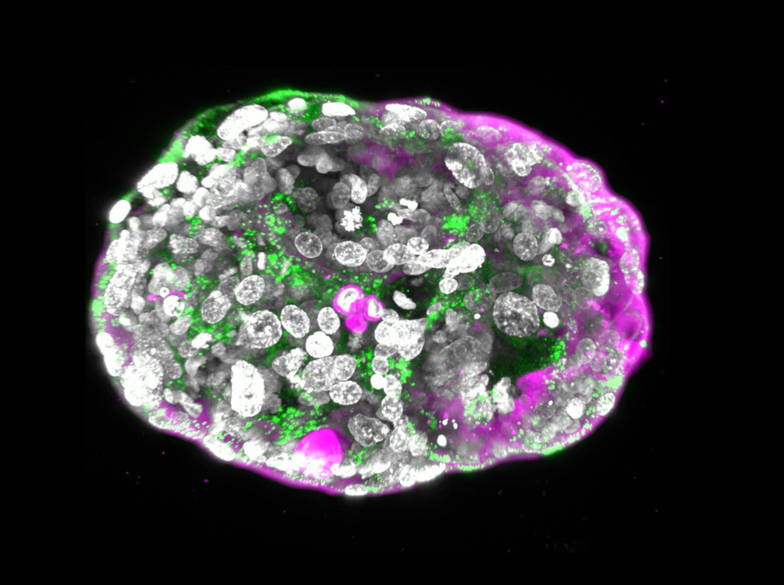 Scientists Grow Model Embryo In Lab, Without Egg Or Sperm