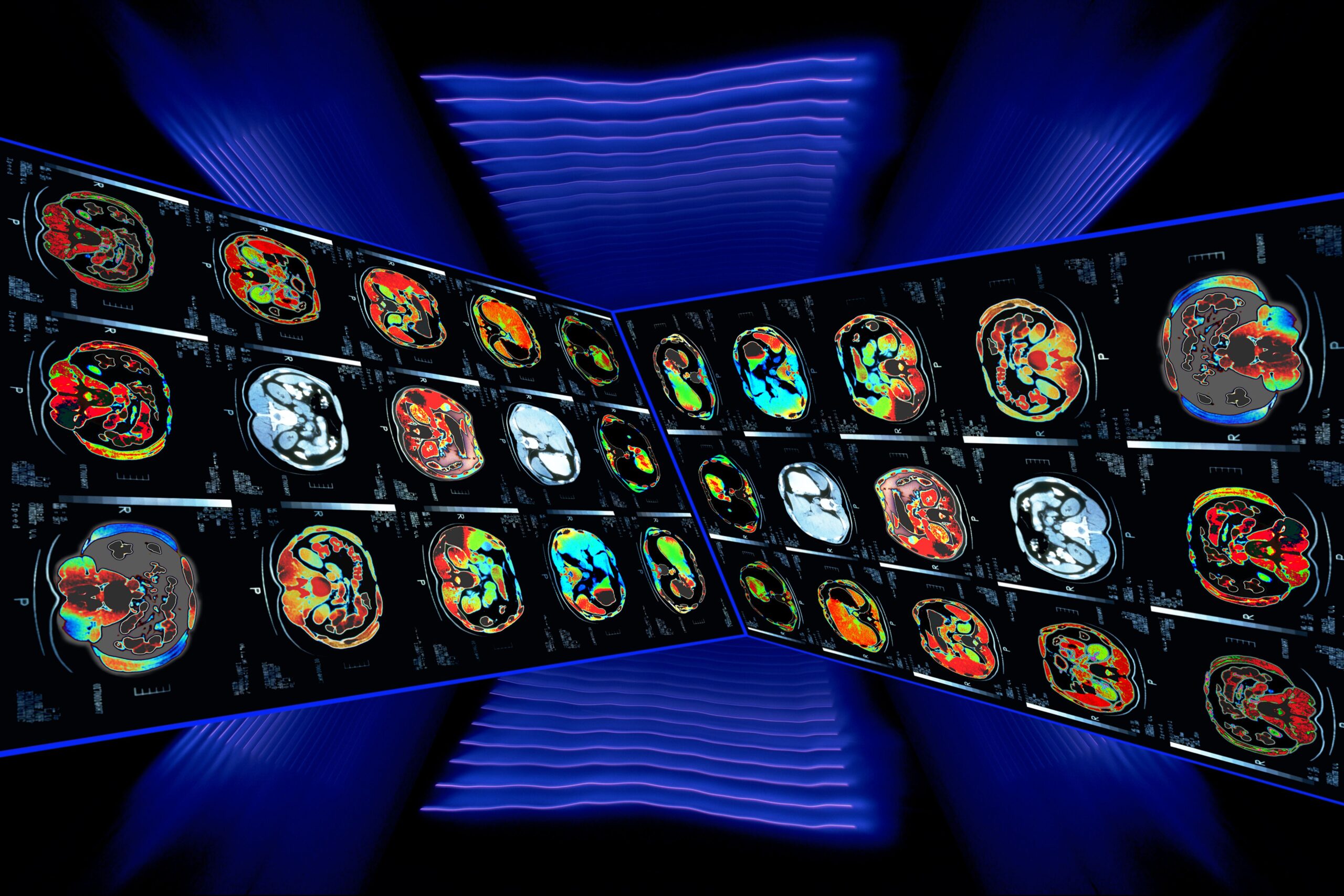 German Health Firm Enlists Israeli 3D Printer To Boost CT Imaging