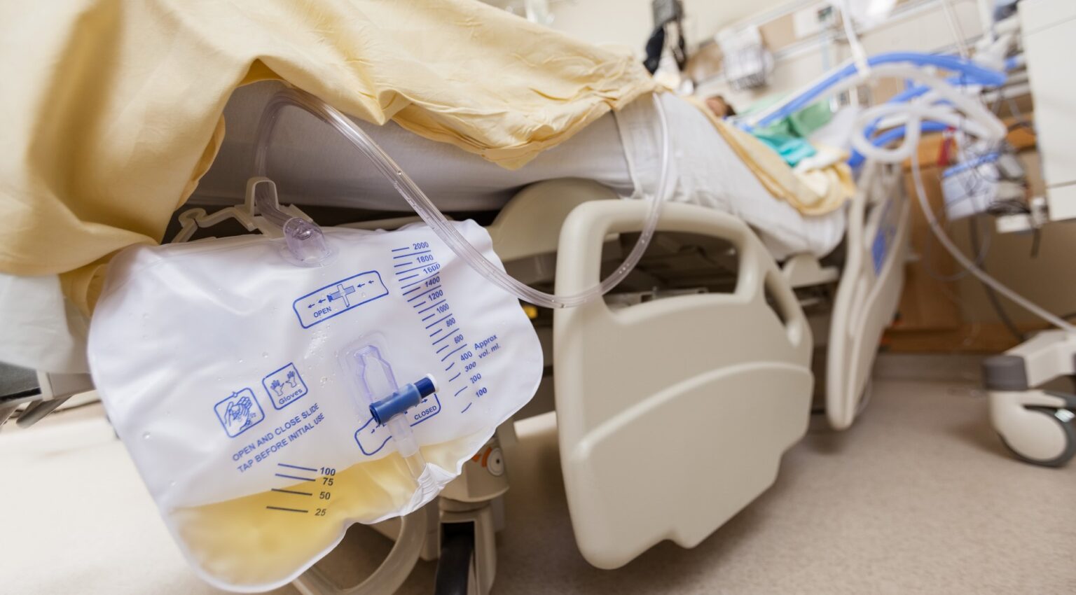 Monitoring Kidney Function With AI Sensor, One Drop At A Time