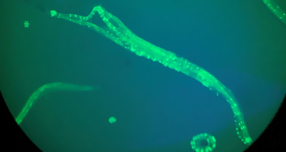 Tiny Worms Offer New Way To Study Human Muscle Diseases