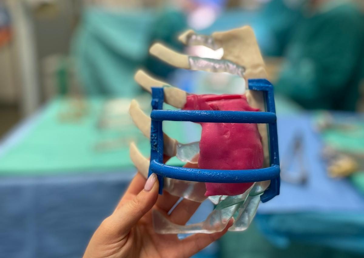 ‘Game-Changing’ Tech 3D-Prints Customized Parts For Patients