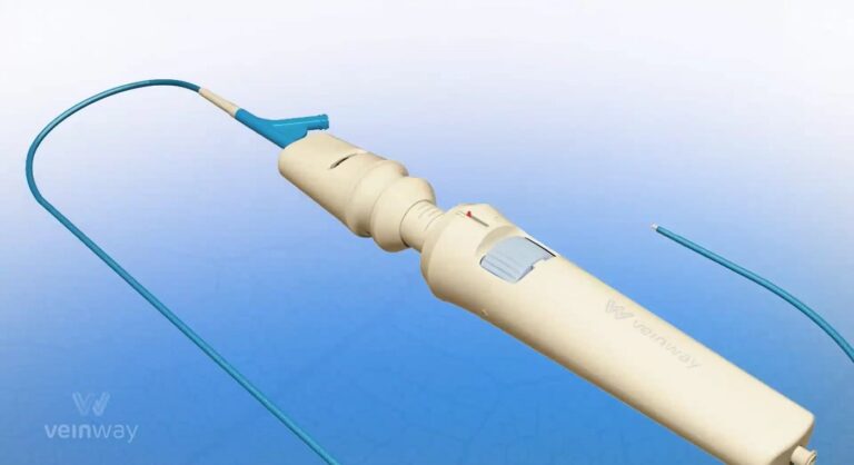 Coming through! Device clears veins blocked by clots, scar tissue