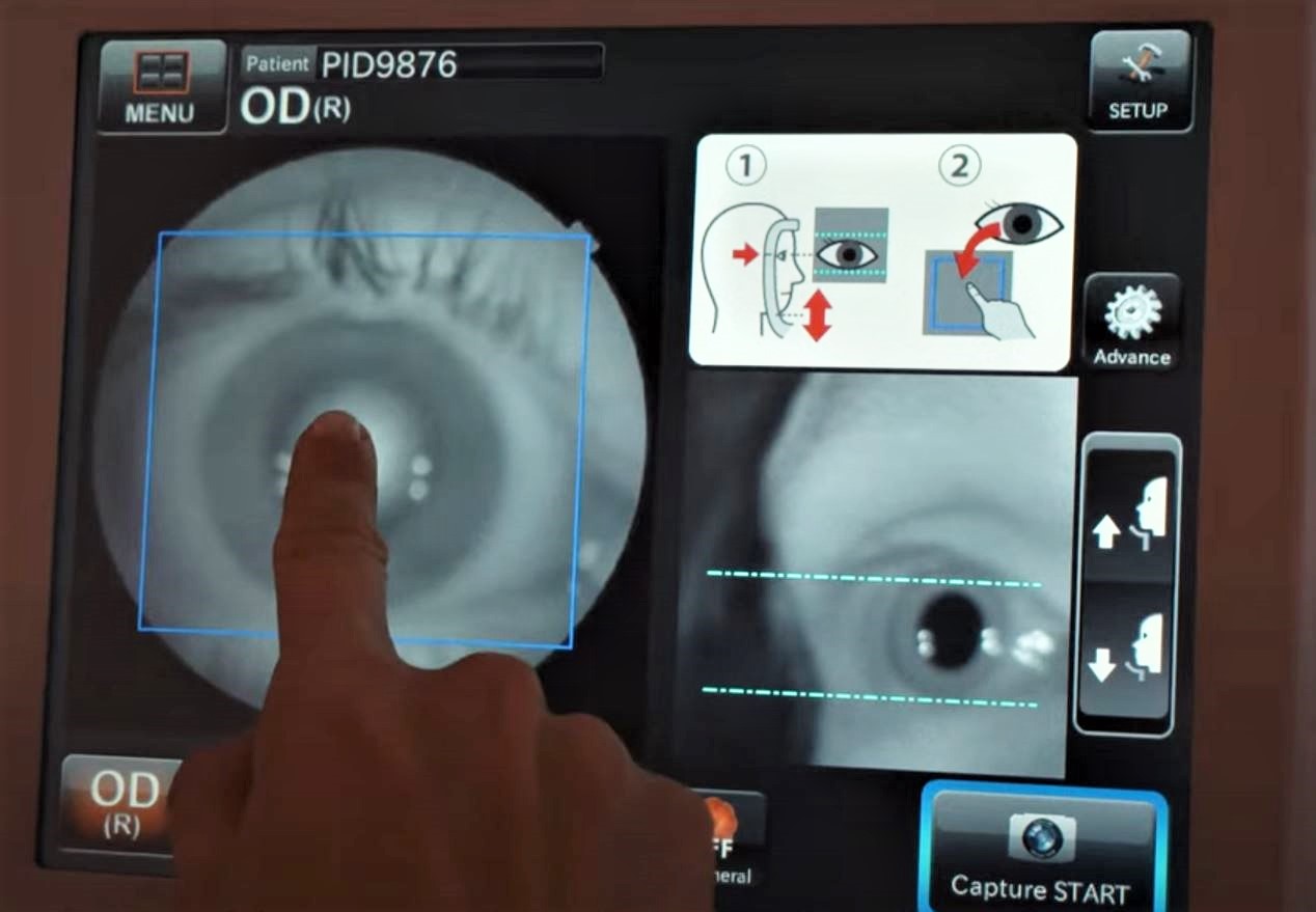 AI Makes Vital Diabetic Eye Test As Simple As Saying Cheese