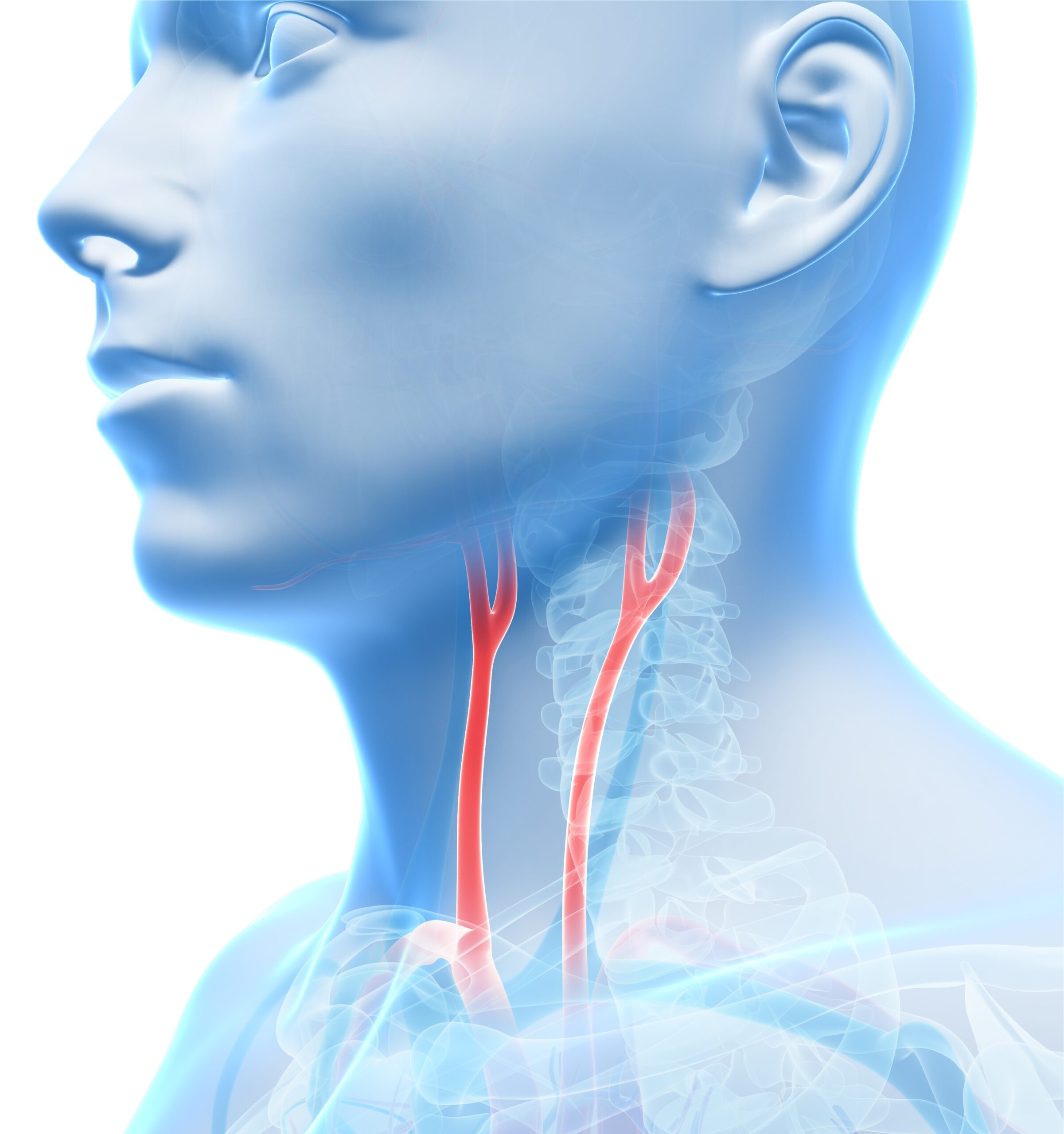 ‘Sewing Machine’ Sutures Simplify Complex Carotid Procedure